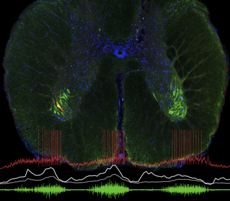 - Petersen Lab - Systems Neuroscience at UCPH